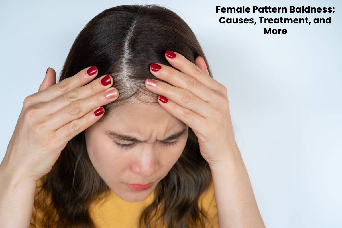 Female Pattern Baldness: Causes, Treatment, and More