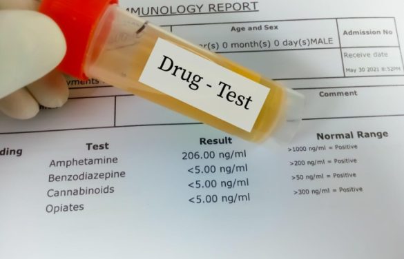 Best Defense For Positive Drug Test - Types and More - Vigor Blog