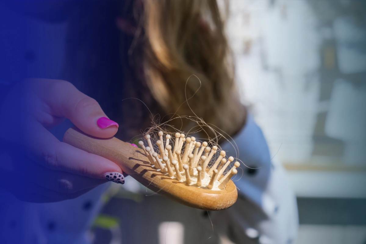 Write About Female Pattern Baldness - Vigor Blog Contributors